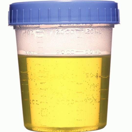 10 Panel UDS Carolina Testing Drugs Alcohol DNA Clinical